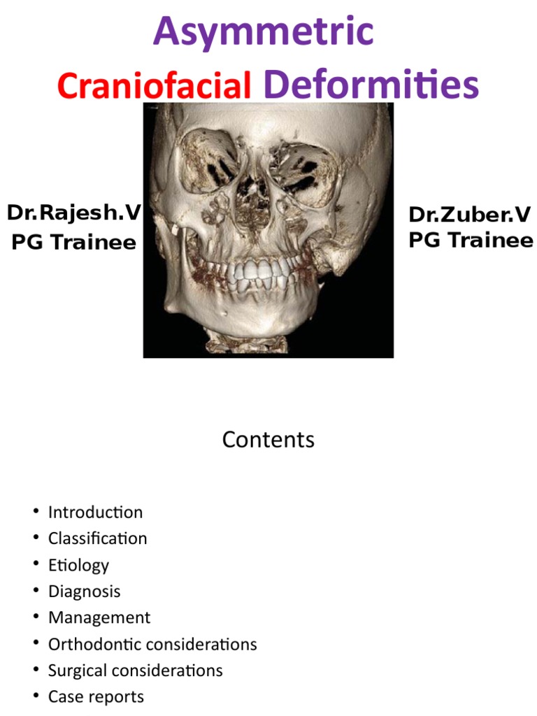 Asymmetric Craniofacial Asymmetries | PDF | Ct Scan | Dentistry Branches
