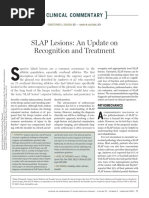 Lima - SMR TT Augmented 360 Metal Back - en | PDF | Shoulder ...