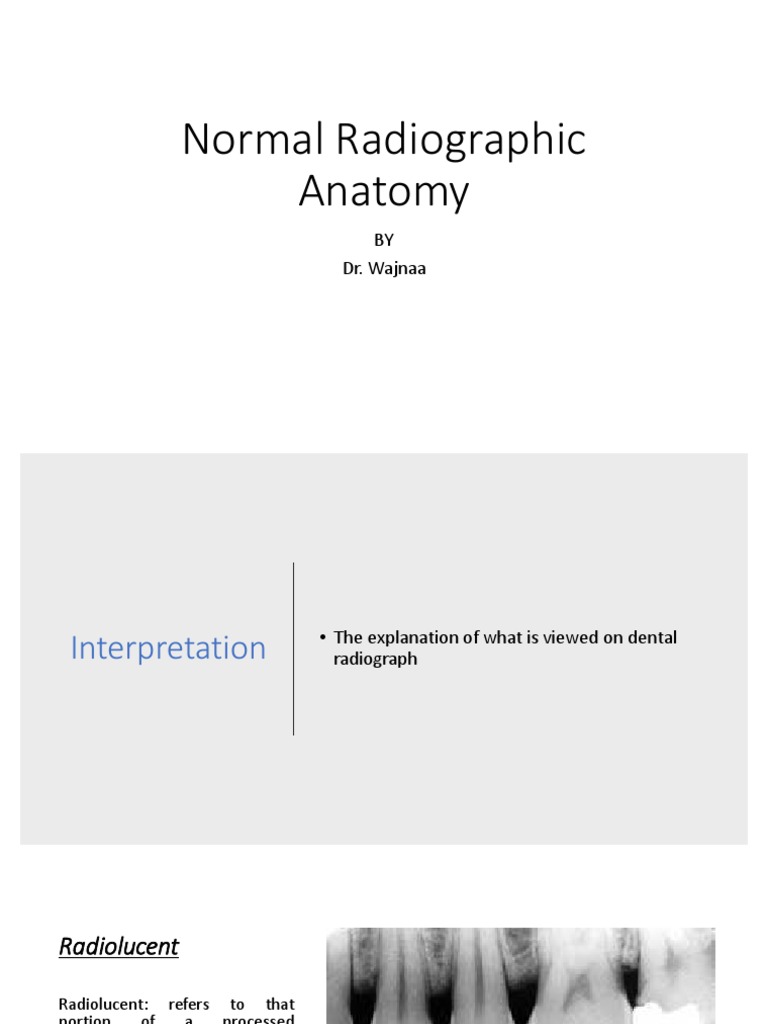 Normal Radiographic Anatomy: BY Dr. Wajnaa | PDF | Mouth | Dentistry ...