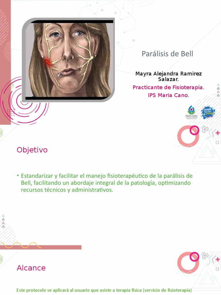 Parálisis De Bell Pp Pdf Terapia Física Especialidades Medicas