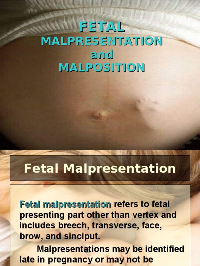 Fetal Malpresentation Guide | PDF | Childbirth | Caesarean Section