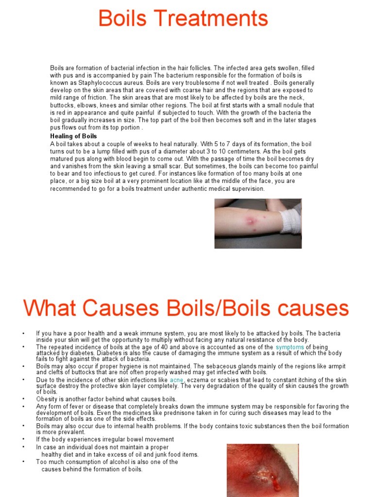Effective Home Remedies for Boils | PDF | Clinical Medicine | Diseases ...