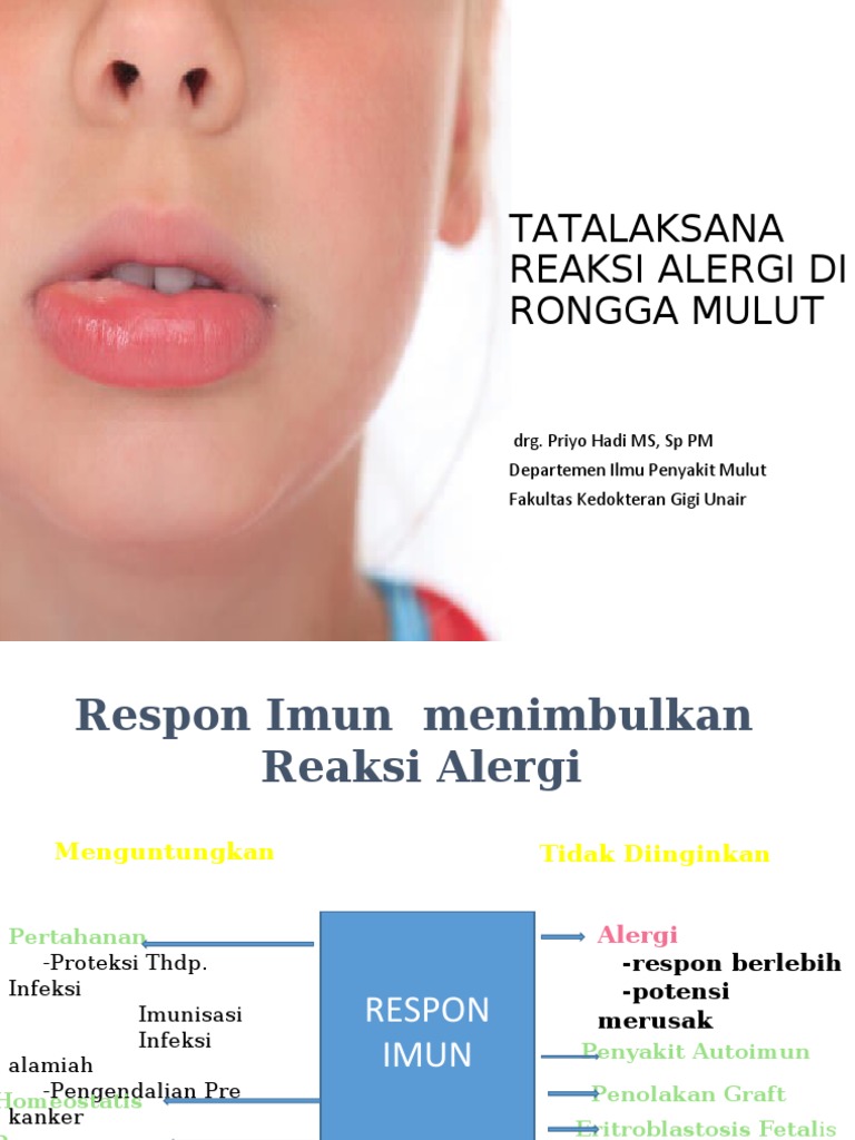 1 TATALAKSANA REAKSI ALERGI DI RONGGA MULUT (Autosaved) | PDF