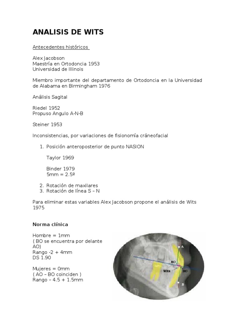 Analisis de Wits | PDF