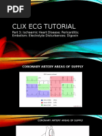 Ecg Interpretation J Point Stemi Criteria Equivalents and Others | PDF ...