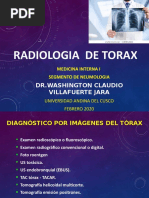Radiografía de Tórax Normal - Patrón Intersticial | PDF | Pulmón | Tórax