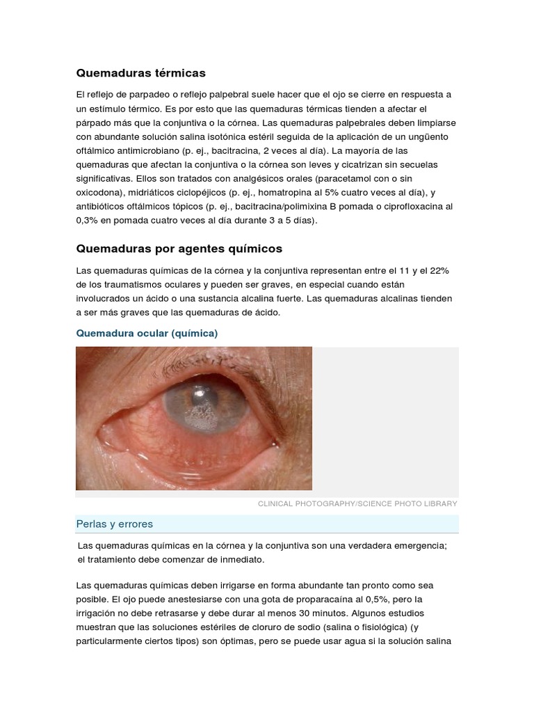 Quemaduras Térmicas | PDF | Quemar | Medicina CLINICA
