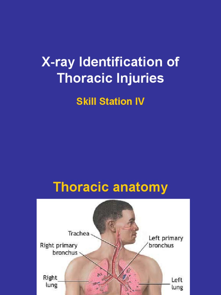 X-Ray Identification of Thoracic Injuries..1 | PDF | Thorax | Thorax ...