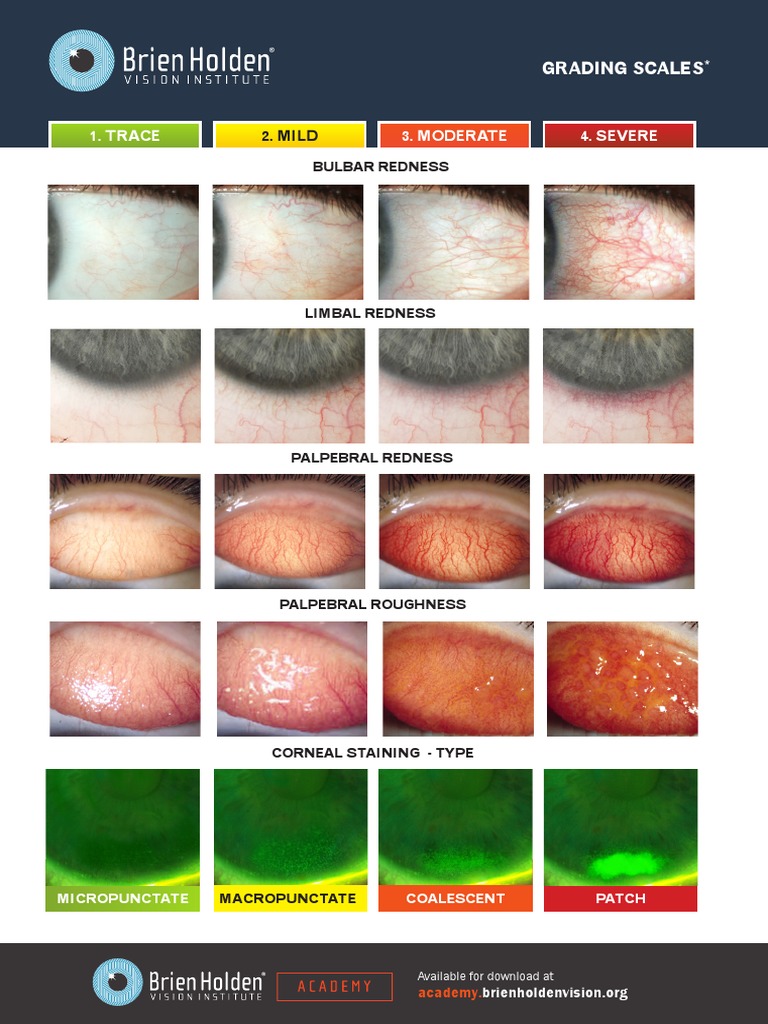 Grading Scale 2017 PDF | PDF | Cornea | Contact Lens