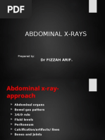 Soflax Tablets: Uses and Dosage Guide | PDF | Bloating | Nausea