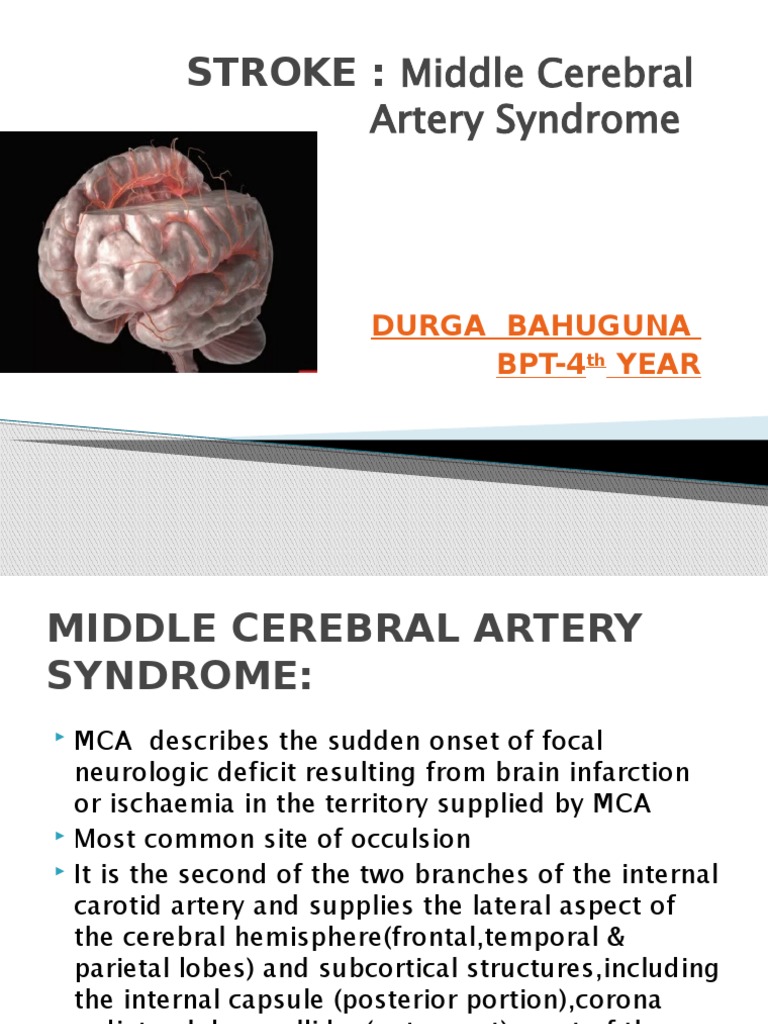 Stroke:: Middle Cerebral Artery Syndrome | PDF | Parietal Lobe | Aphasia