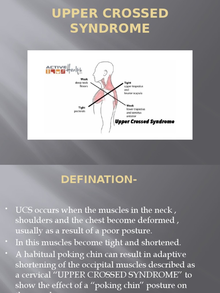 Upper Crossed Syndrome | PDF | Anatomical Terms Of Motion | Neck