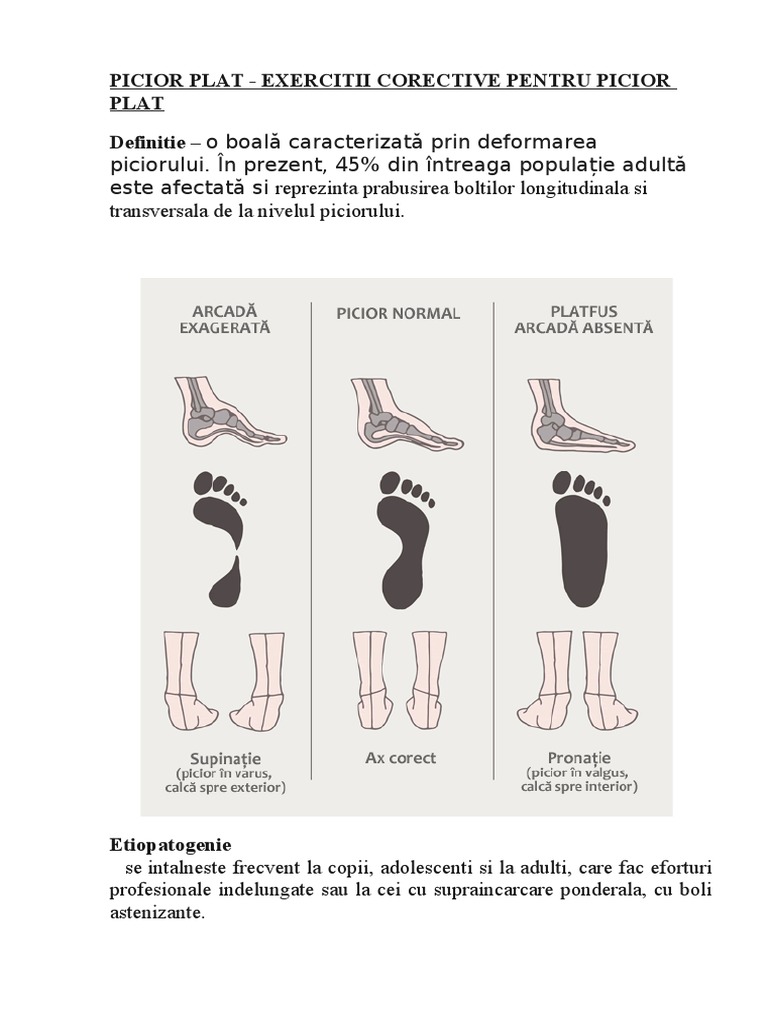 Picior Plat | PDF