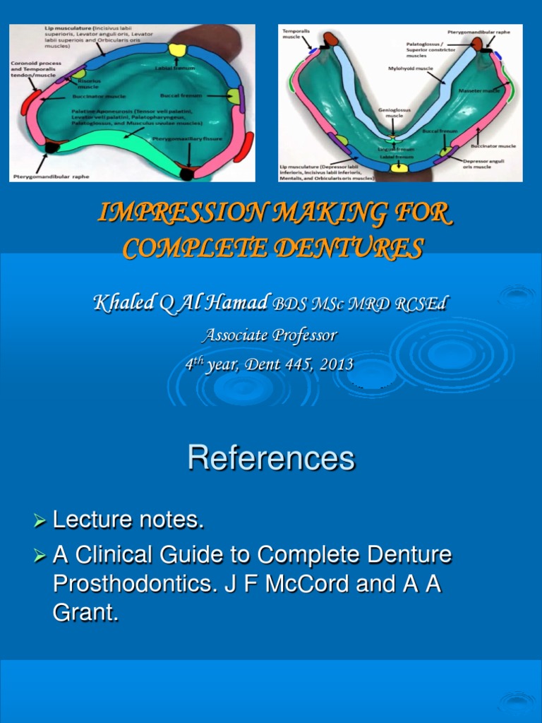 Prostho IV Slide 3 Impression Making For Complete Dentures | PDF ...