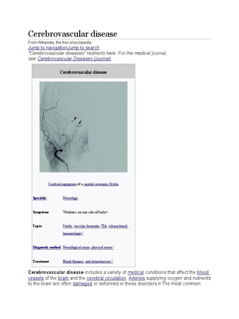Cerebrovascular Disease | PDF | Stroke | Human Anatomy