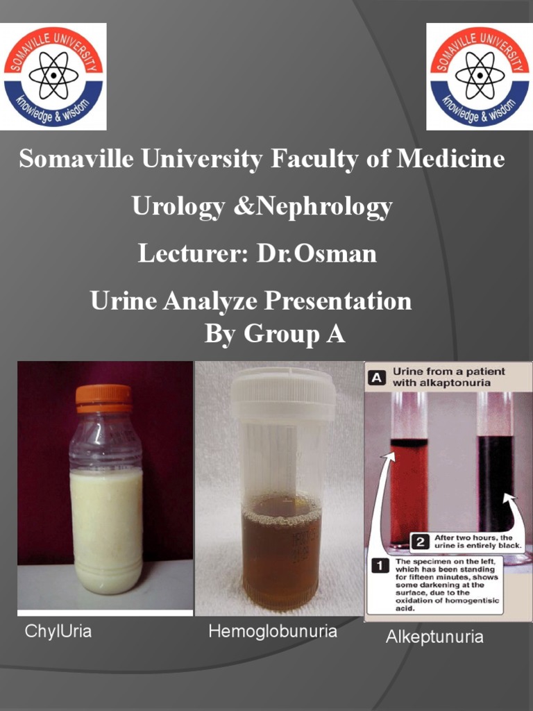 Urine Analysis | PDF | Creatinine | Urine