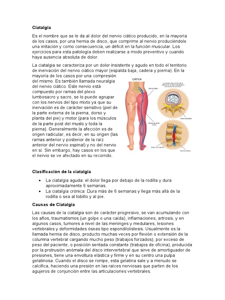 Ciatalgia | PDF | Nervio | Rodilla