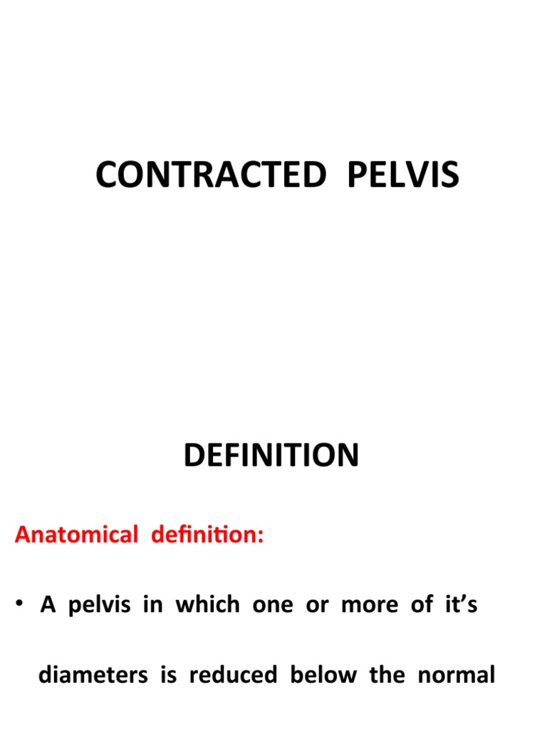 Contracted Pelvis