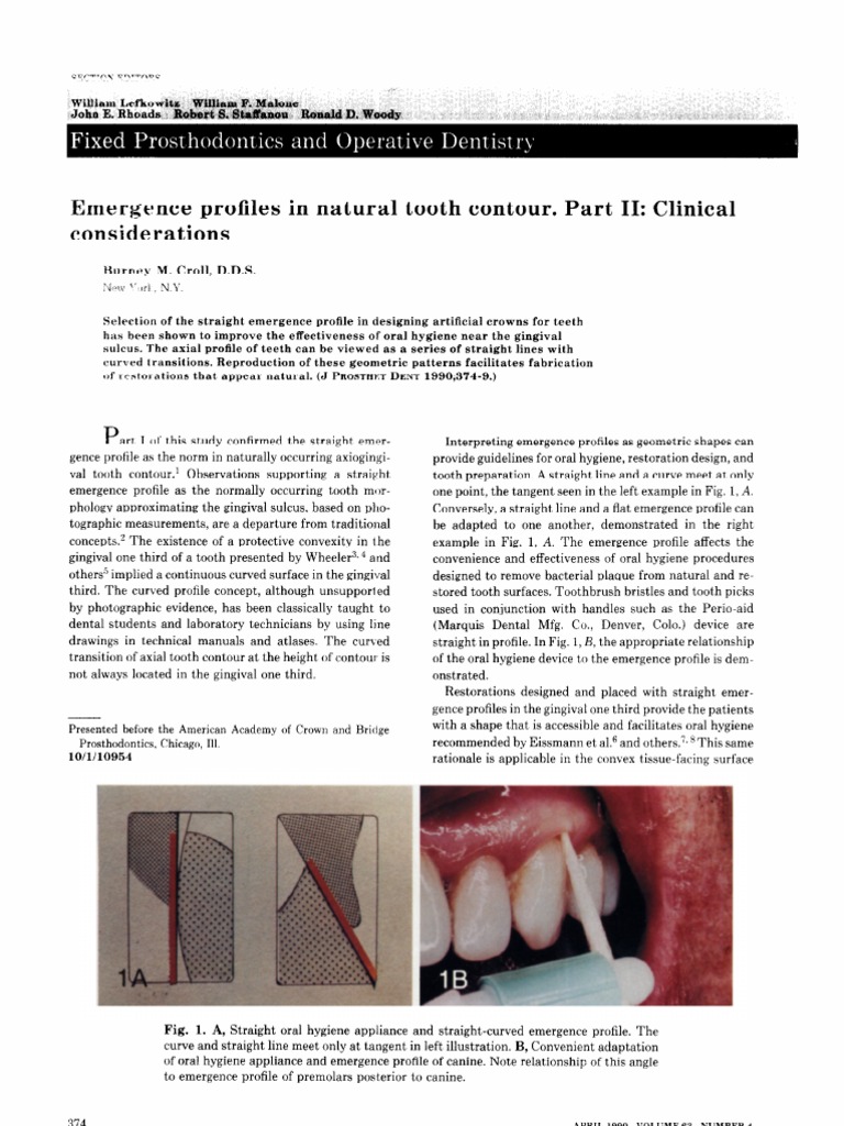 Emergence Profile in Natural Tooth Contour | Oral Hygiene | Tooth