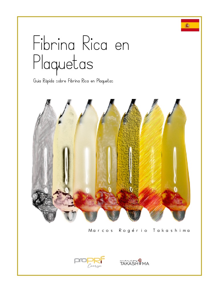 PRF - Guía Rápida sobre Fibrina Rica en Plaquetas.pdf | Plaqueta ...