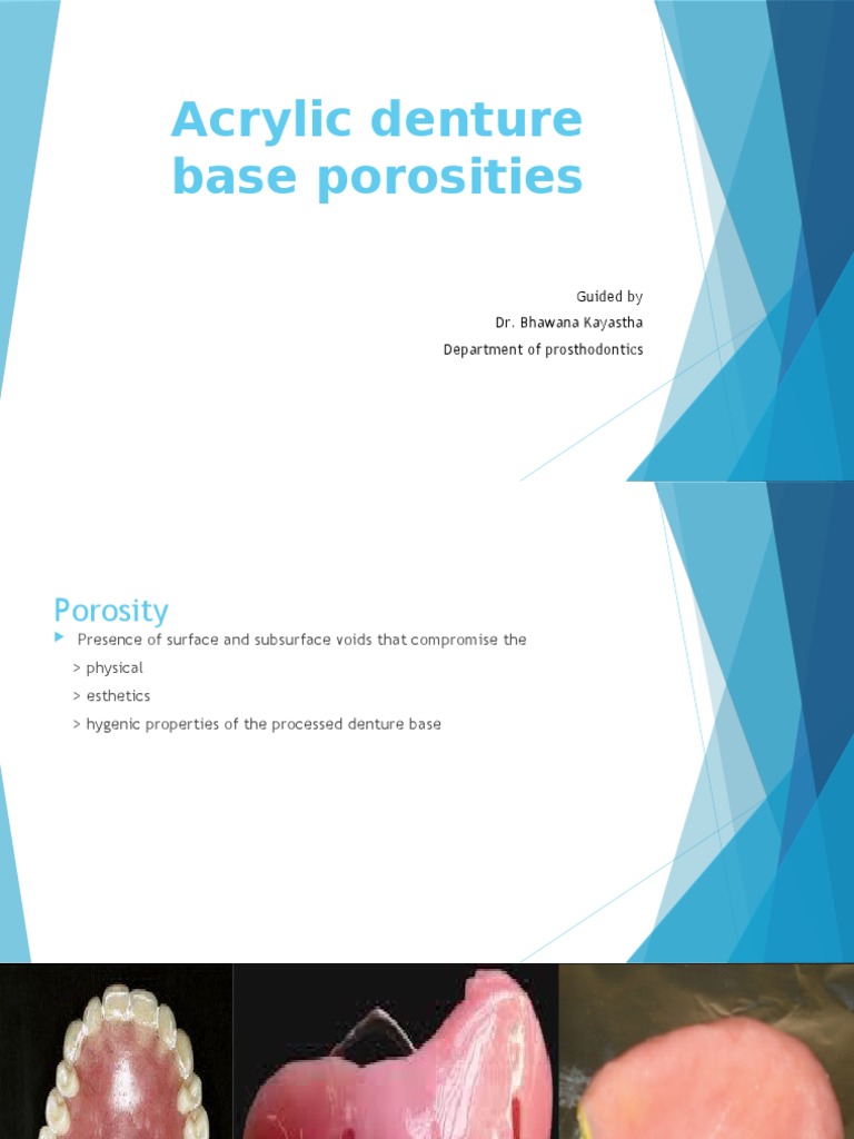 Acrylic Denture Base Porosities | PDF