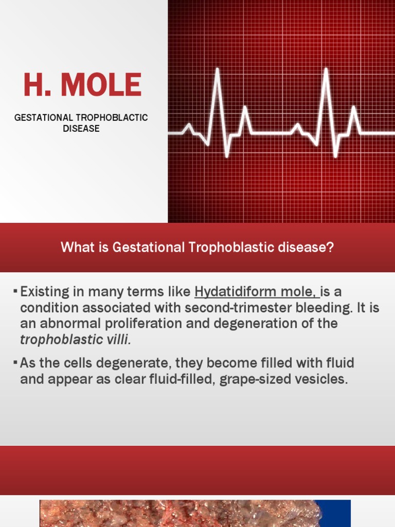 H Mole Case Presentation | PDF | Human Reproduction | Medical Specialties