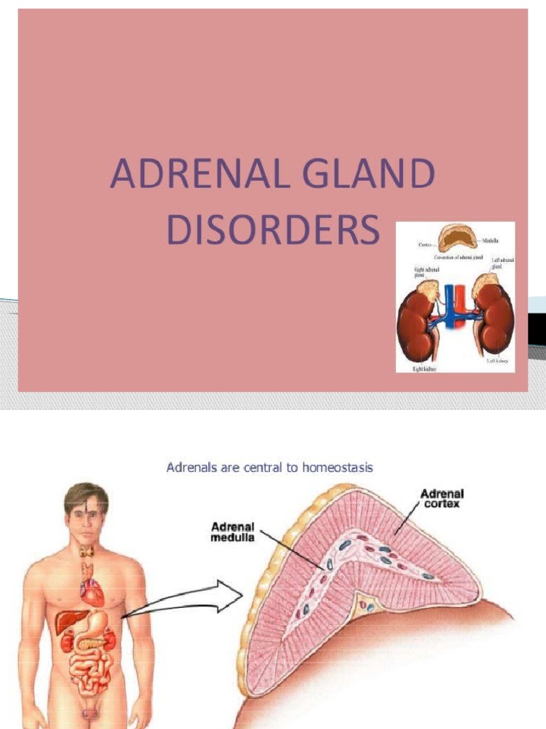 Addison's Disease | PDF | Adrenal Gland | Epidemiology