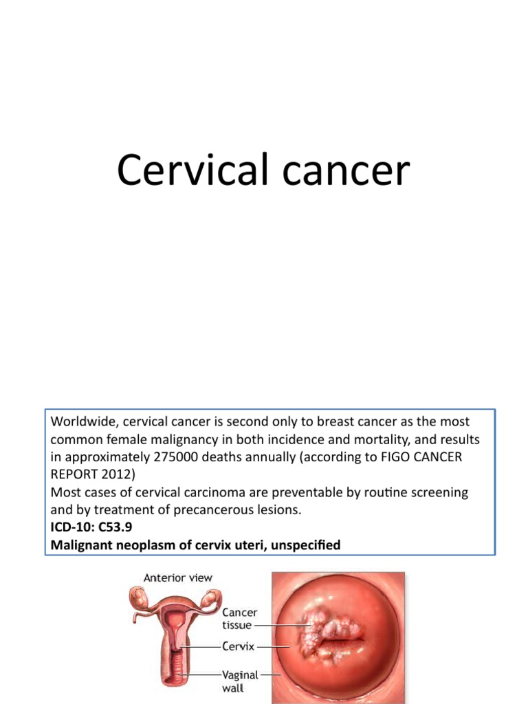Cervical Cancer | PDF | Cervical Cancer | Neoplasms