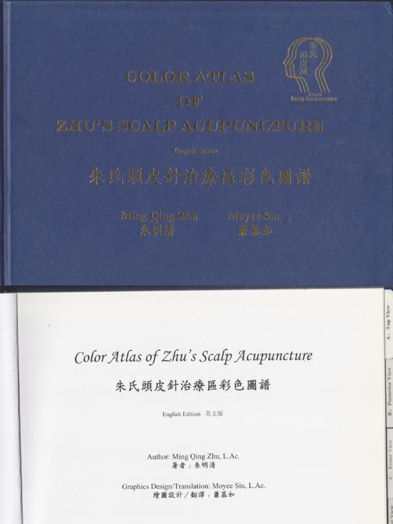 Ming Qing Zhu - Color Atlas of Zhu's Scalp Acupuncture-Zhu's Neuro ...