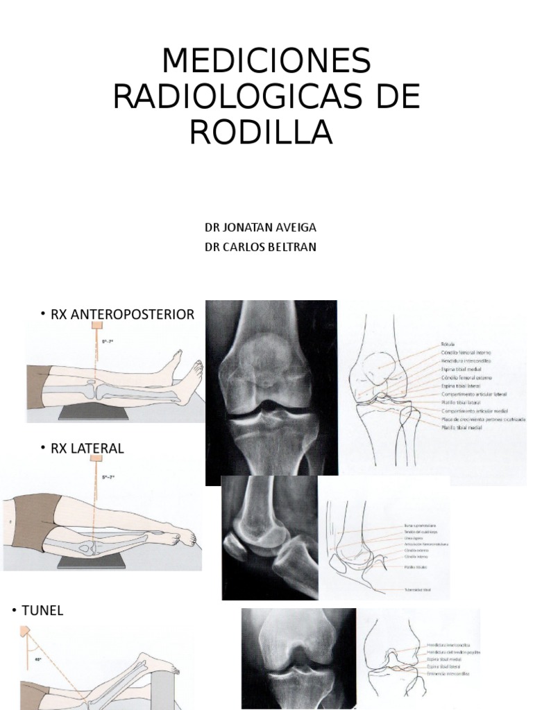 Mediciones Radiológicas de La Rodilla | PDF | Rodilla | Extremidades ...