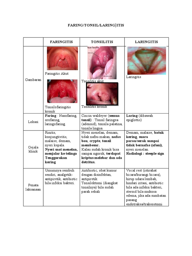 Faringitis, Laringitis, Tonsilitis | PDF