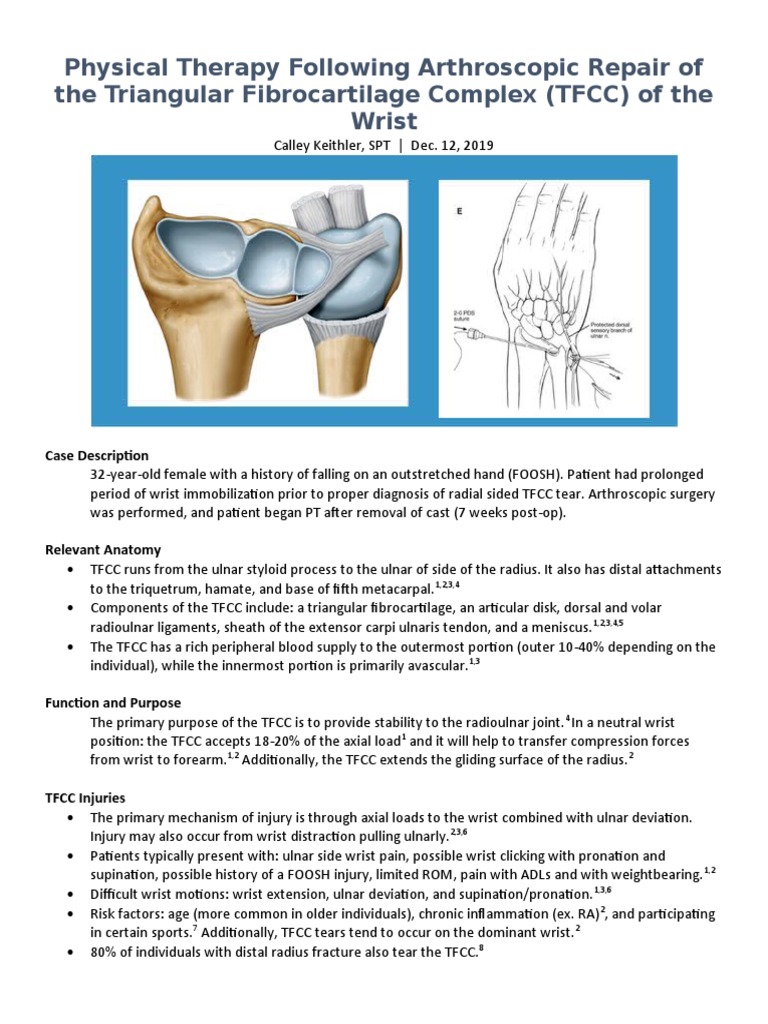 Case Report Presentation - TFCC | PDF | Joints | Clinical Medicine