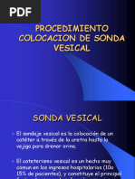 CISTOCLISIS | PDF | Vejiga urinaria | Orina