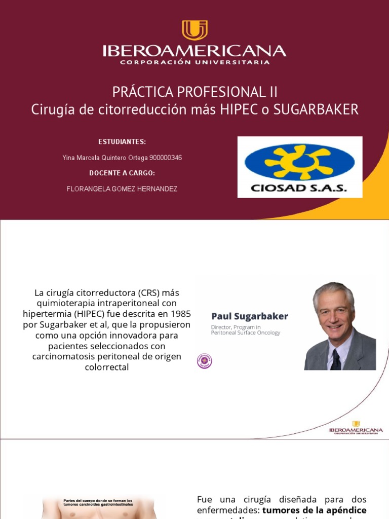 HIPEC o SUGARBAKER | PDF | Peritoneo | Cáncer