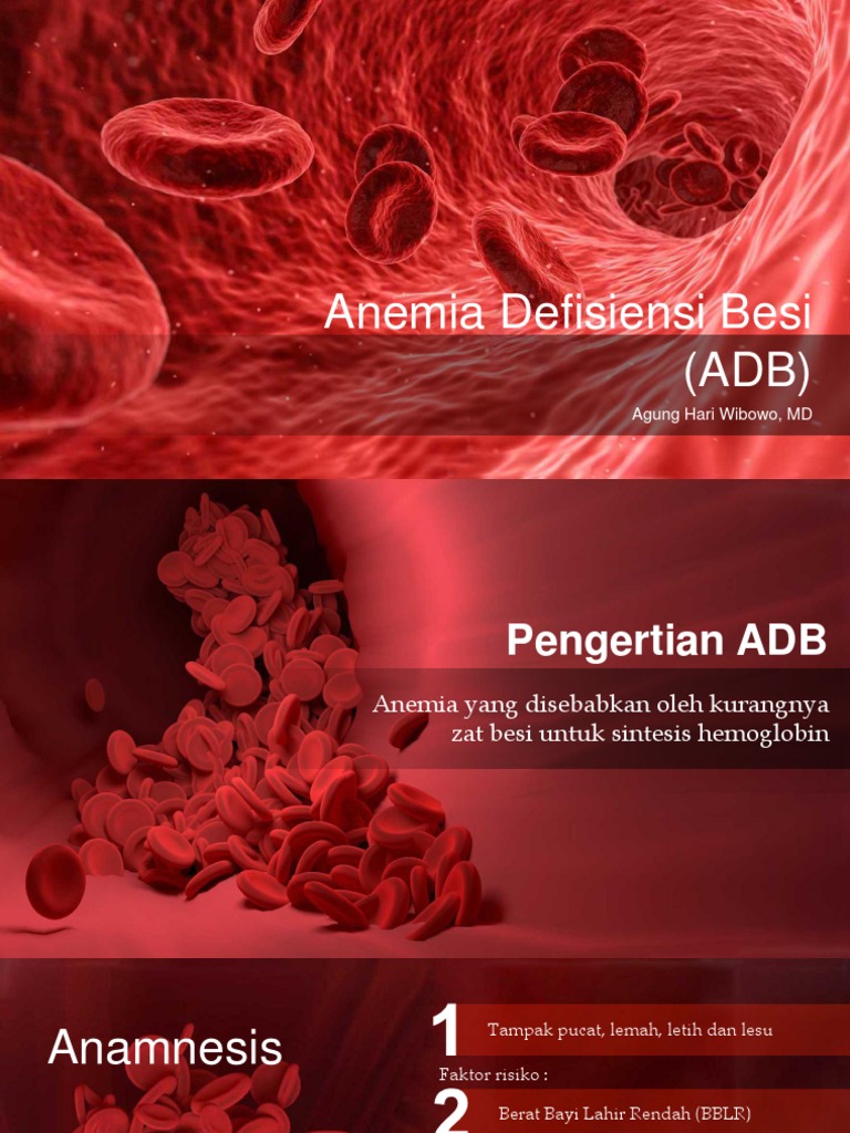 Anemia Defisiensi Besi (ADB) | PDF