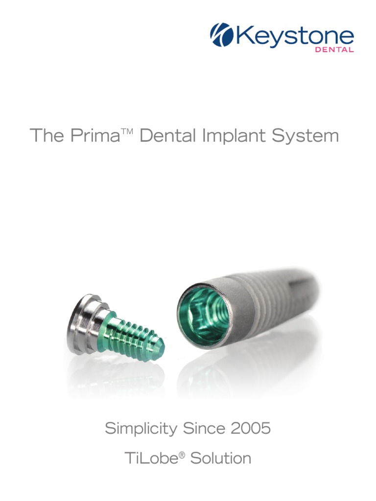 The Prima Dental Implant System: Simplicity Since 2005 Tilobe Solution ...