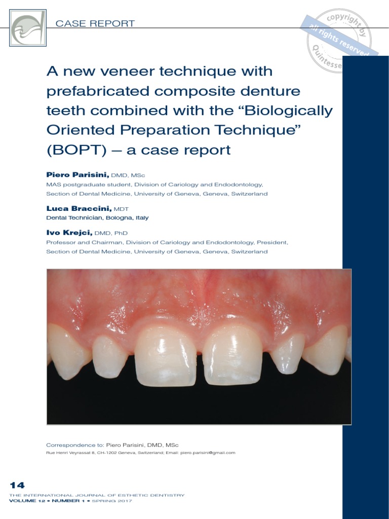 A New Veneer Technique With Prefabricated Composite Denture Teeth Combined With The ...