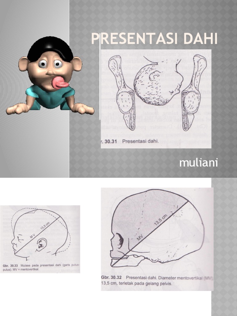 Presentasi Dahi | PDF