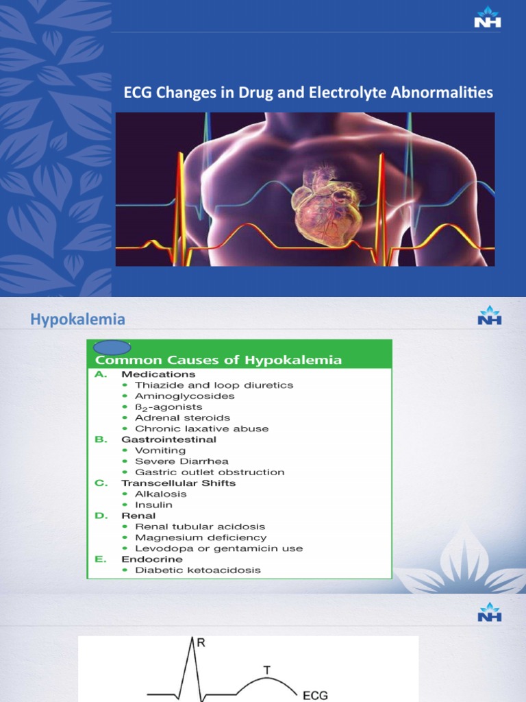 ECG Changes in Drug and Electrolyte Abnormalities | PDF ...