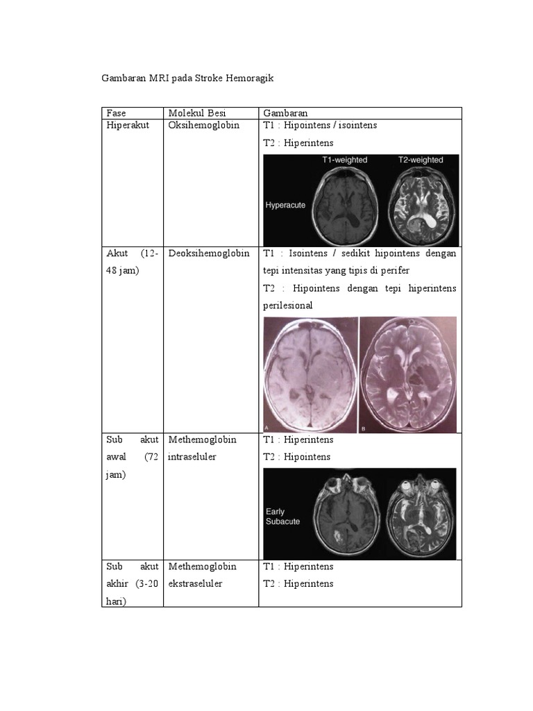Gambaran Mri Pada Stroke Hemoragik Pdf