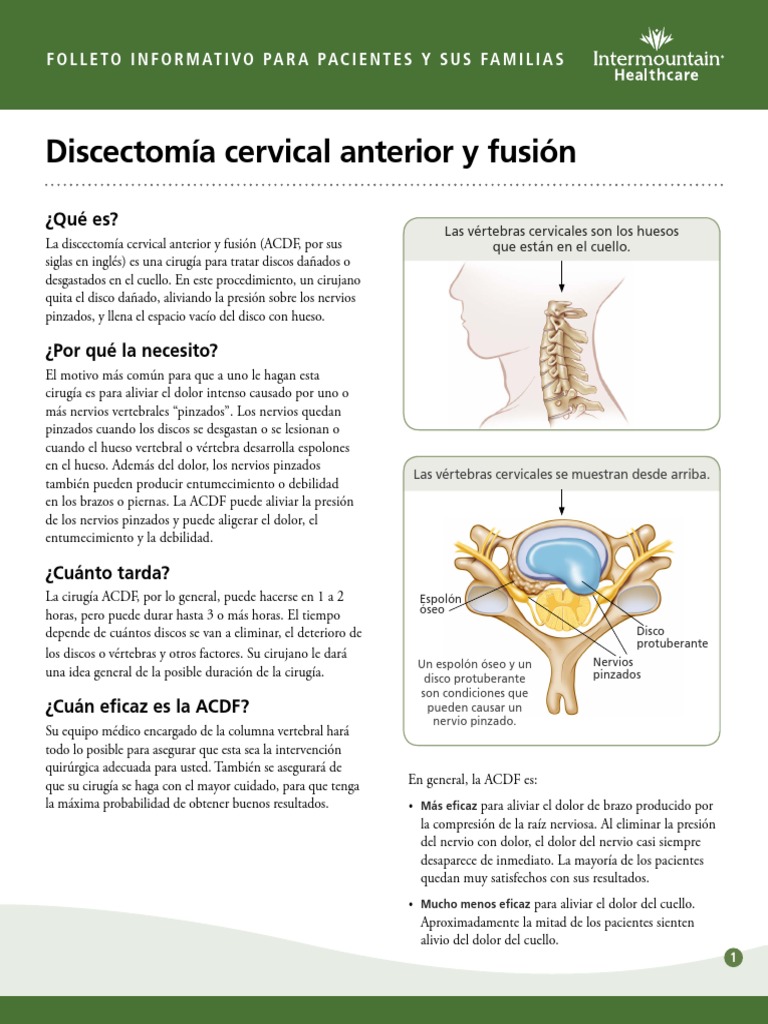 Discectomía Cervical Anterior | PDF | Cirugía | Hueso