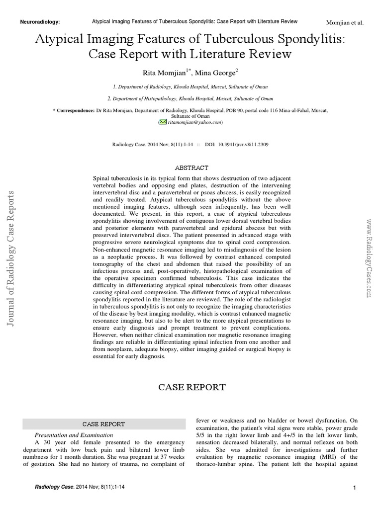Spondilitis TB | PDF | Vertebral Column | Tuberculosis