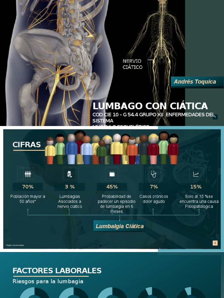 Lumbago Con Ciatica 2 | PDF | Dolor lumbar | Síntomas y signos