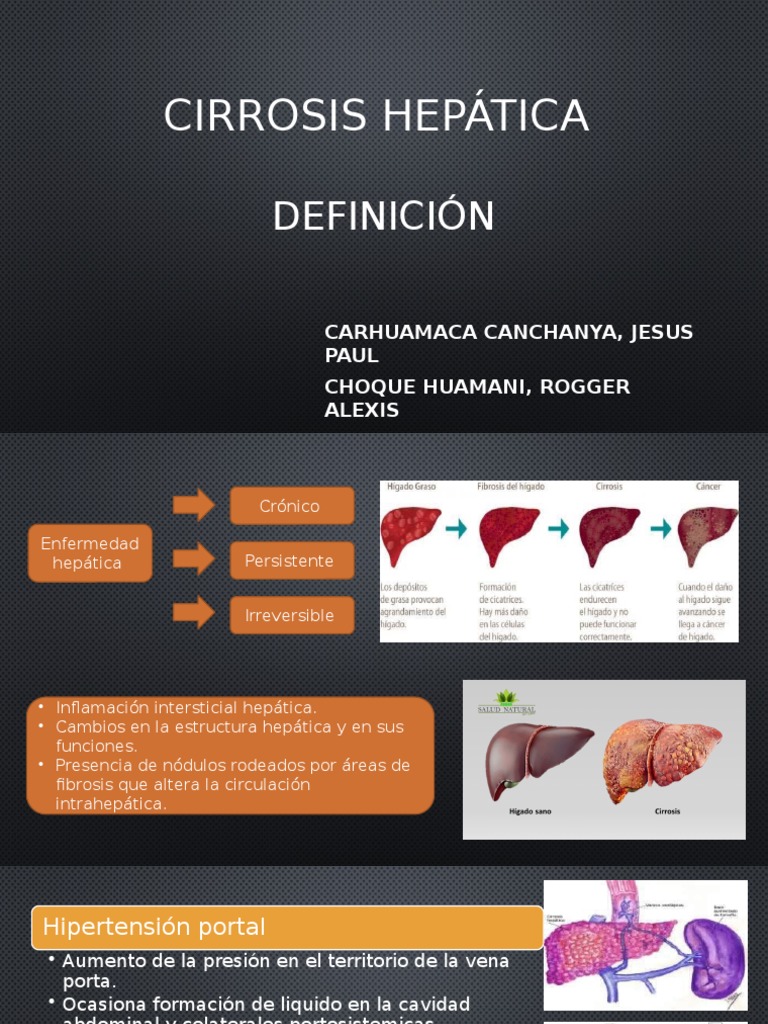Cirrosis Hepatica-Definicion | PDF