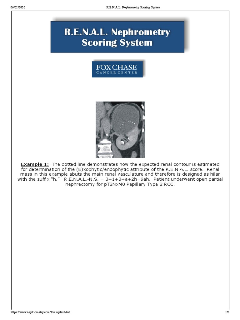 R.E.N.A.L. Nephrometry Scoring System | PDF | Kidney | Neoplasms