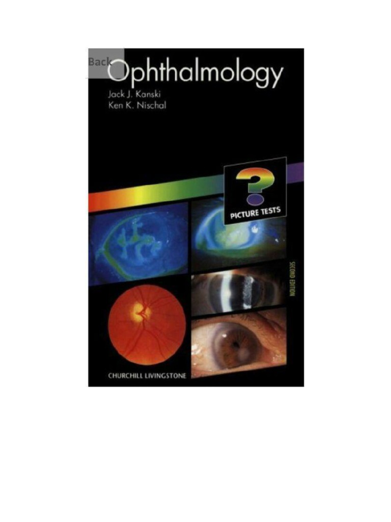 Kanski Picture Test | Download Free PDF | Glaucoma | Retina