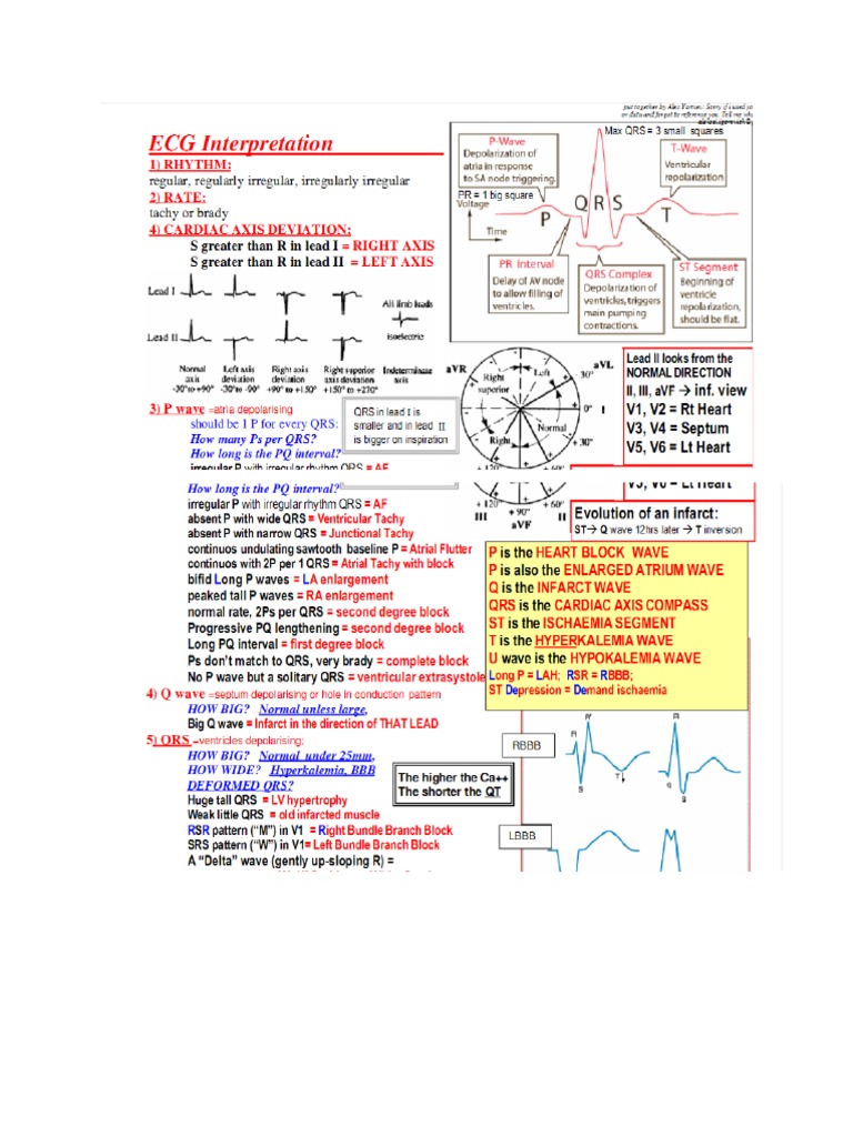 ECG Cheat Sheet-1 | PDF