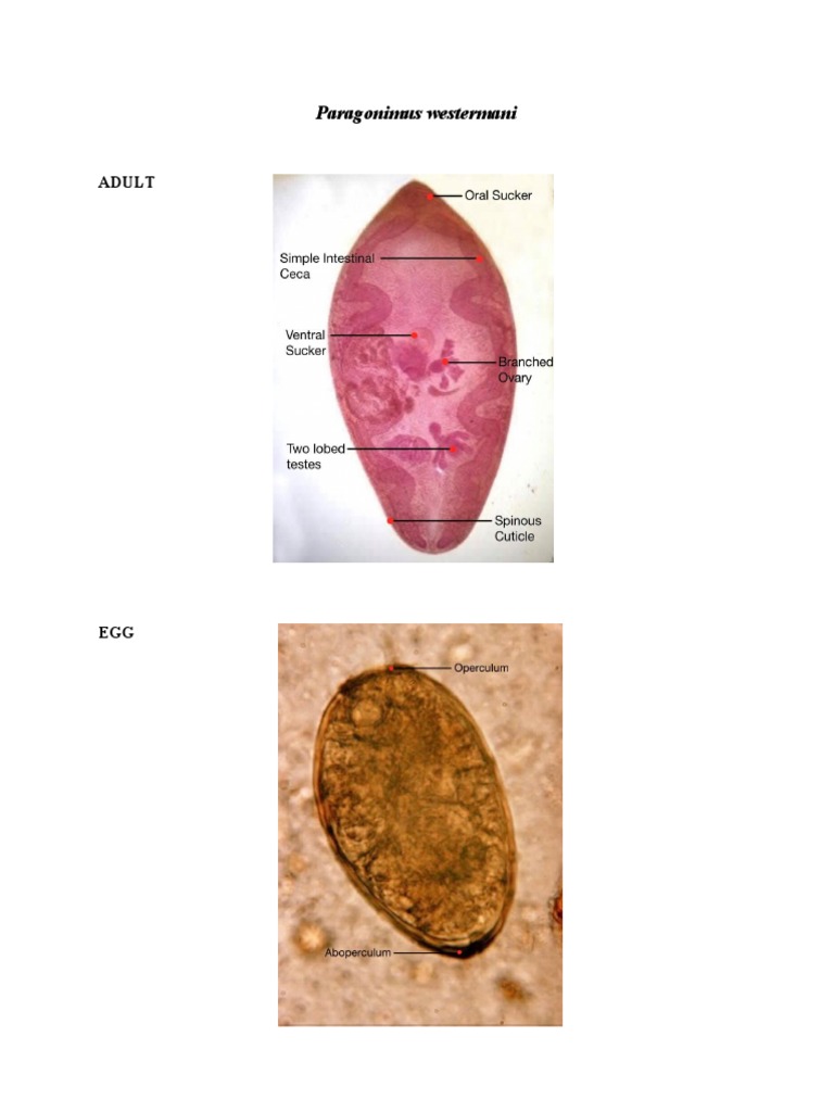 Paragonimus Westermani