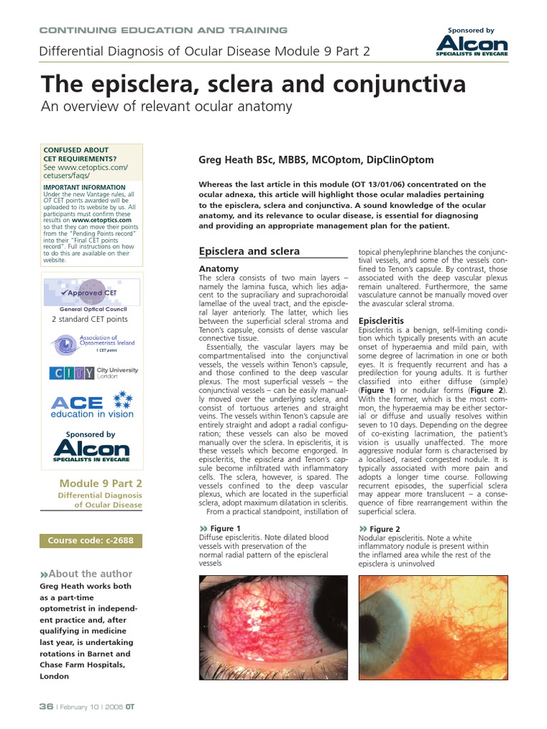 The Episclera, Sclera and Conjunctiva | PDF | Ophthalmology | Medical ...