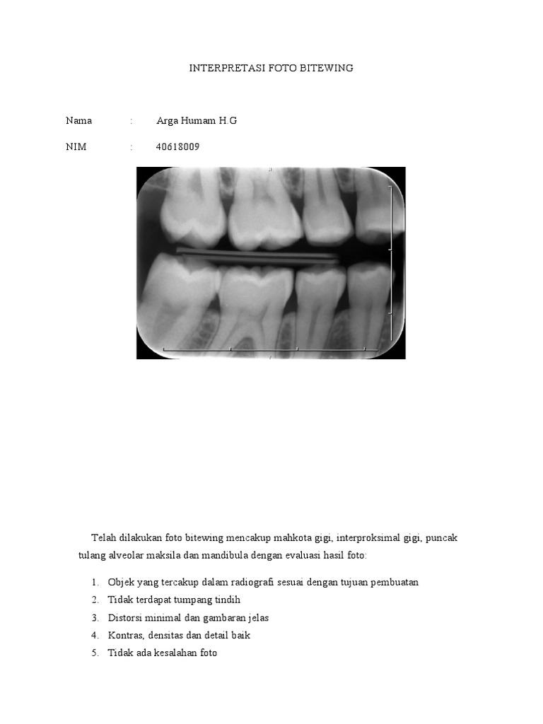 Interpretasi Foto Radiografi Bitewing | PDF